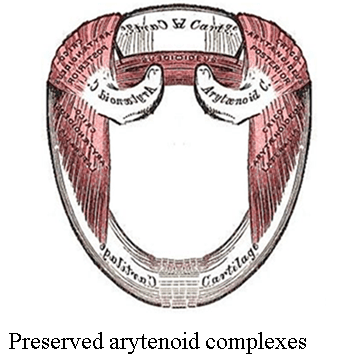 Arytenoid complex – African Head & Neck Society (AfHNS) Clinical ...